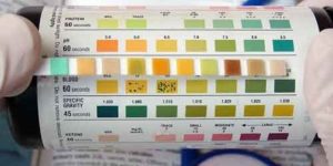 How to Read a Urine Test Strip: A Step-by-Step Guide