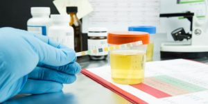 Why Storing Urine Matters