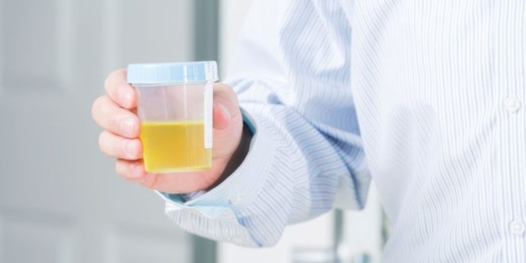 Why Storing Urine Matters